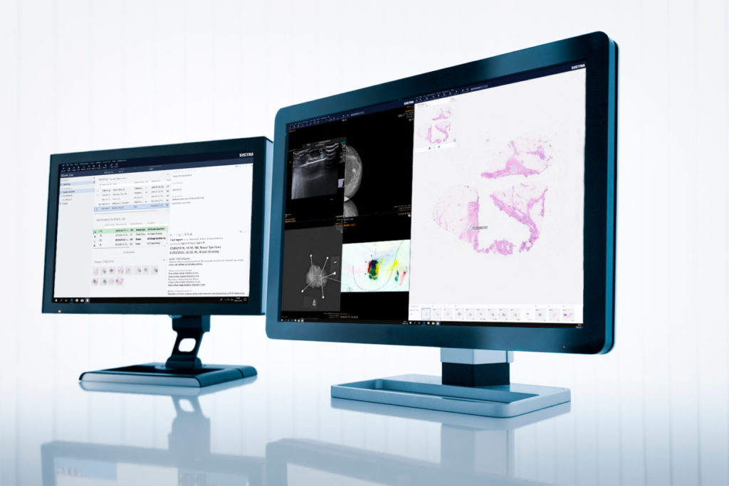SECTRA PACS – ixomed